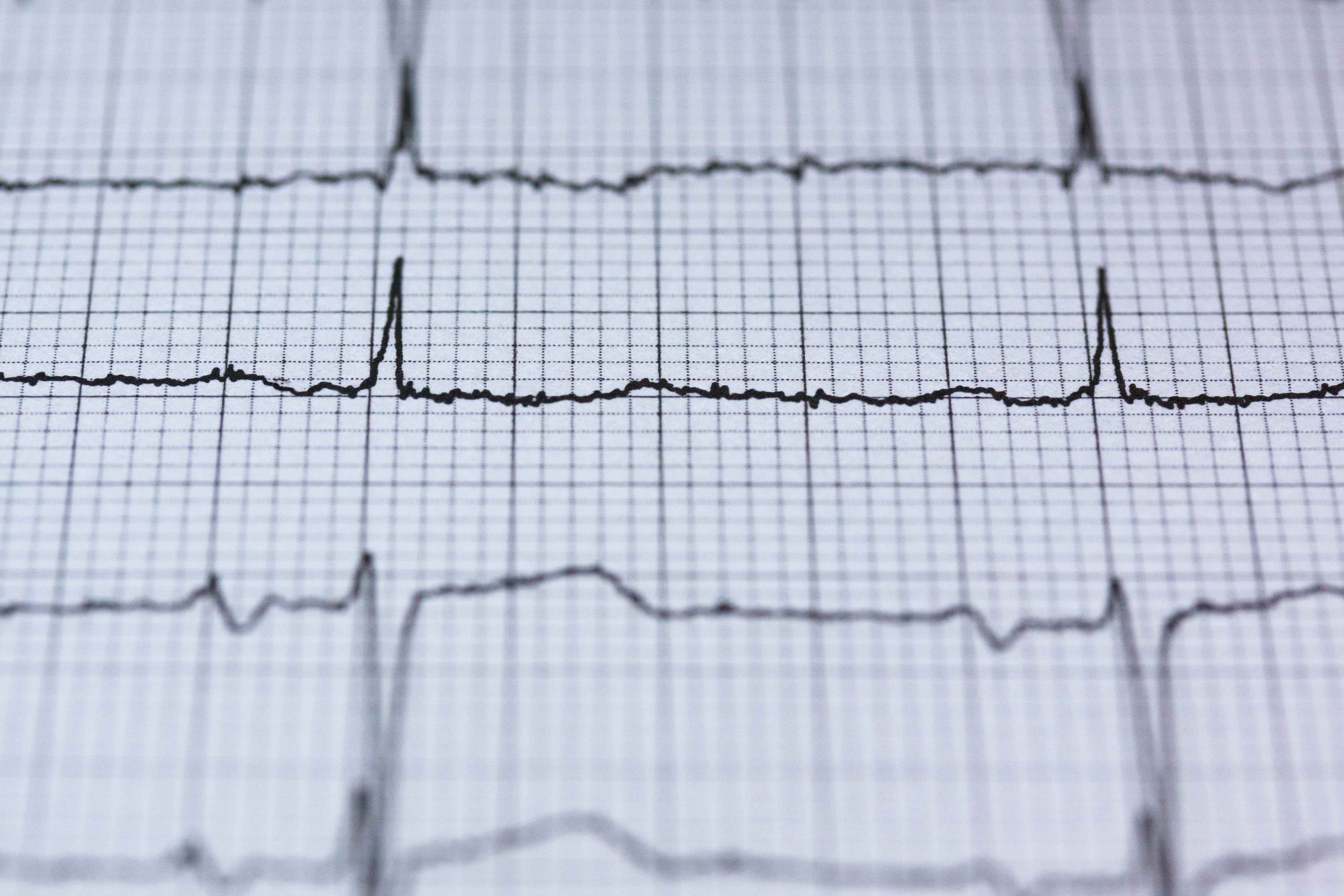 Technology, Rhythm, Result, Close-Up, Diagram, Ecg, No People ...